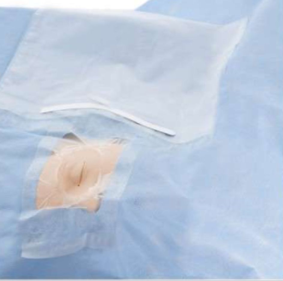 Ophthalmic Drapes And Packs - Ophthalmic Surgical Drapes | Plasti Surge ...