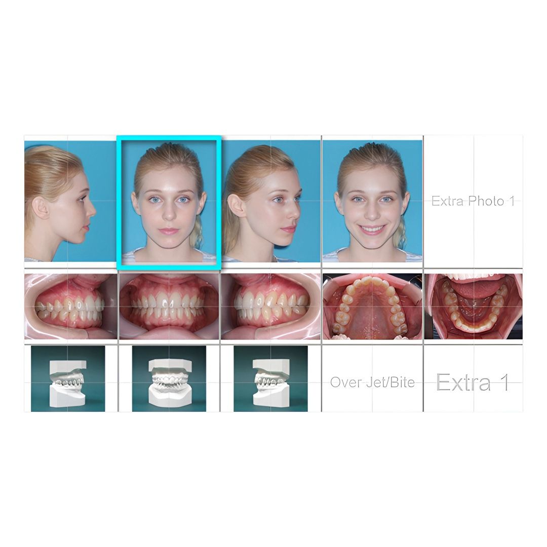 OrthoVision™ 2D Dental Software by Vatech