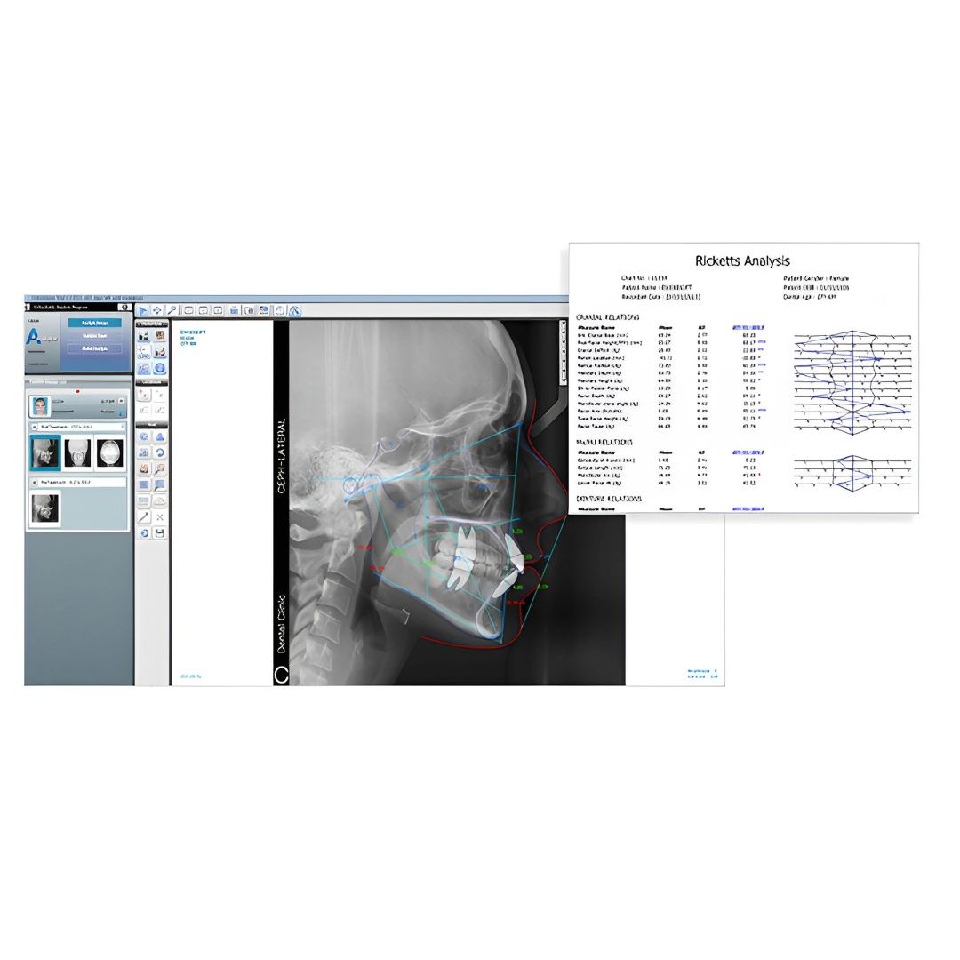 OrthoVision™ 2D Dental Software by Vatech