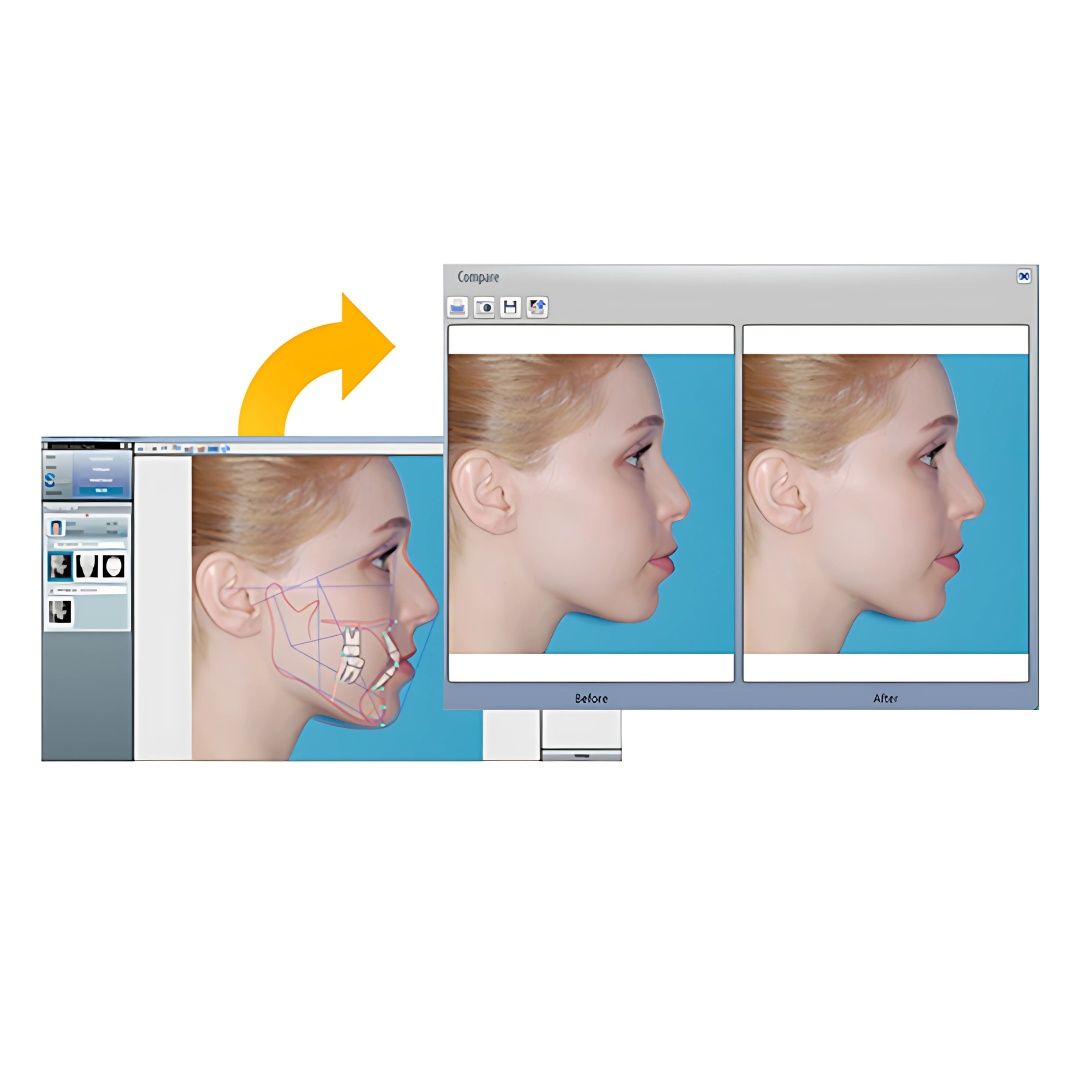 OrthoVision™ 2D Dental Software by Vatech