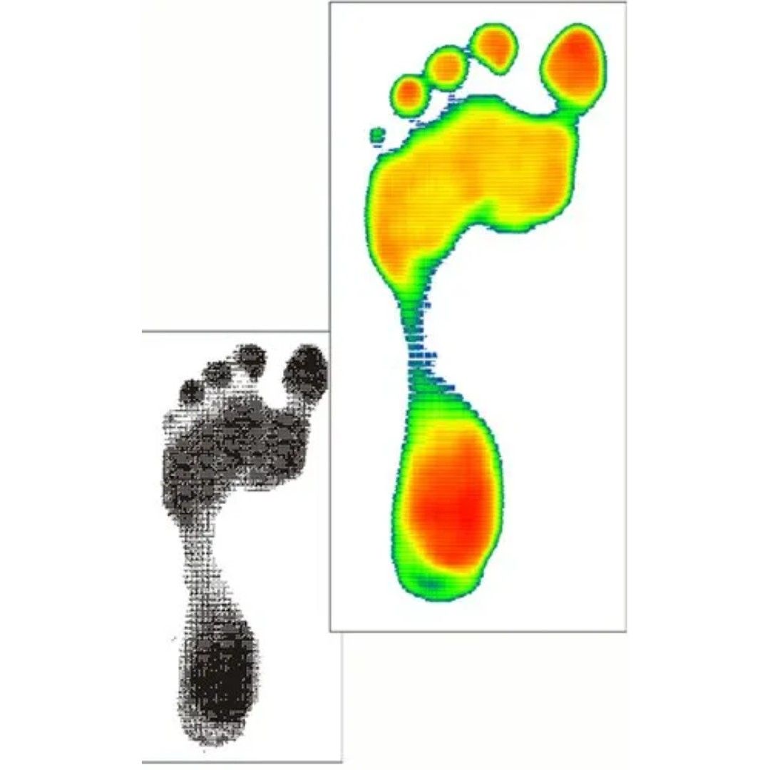 Podiascan Plantar Pressure Measurement System - Diabetik Foot Care ...