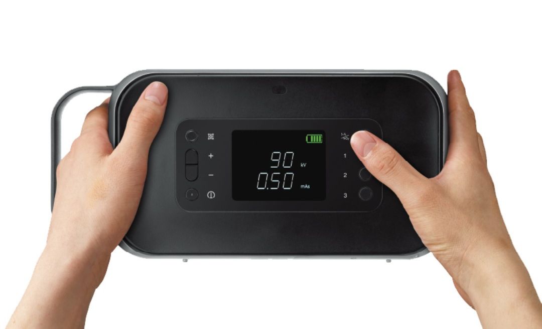 Portable X-ray Unit FDR Xair - portable digital radiography x-ray ...