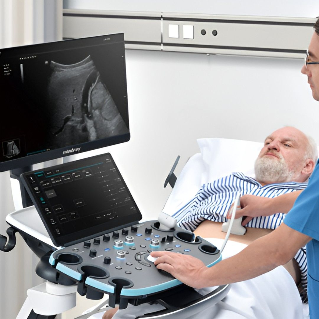 Resona I9 Ultrasound System by Mindray | Top Quality Imaging Technology