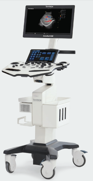 Sonorad V20 - Ultrasound Dopplers - Trivitron Healthcare | Medzell