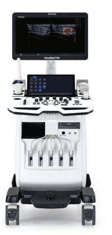 SonoRad V60 - Ultrasound Dopplers - Trivitron Healthcare | Medzell