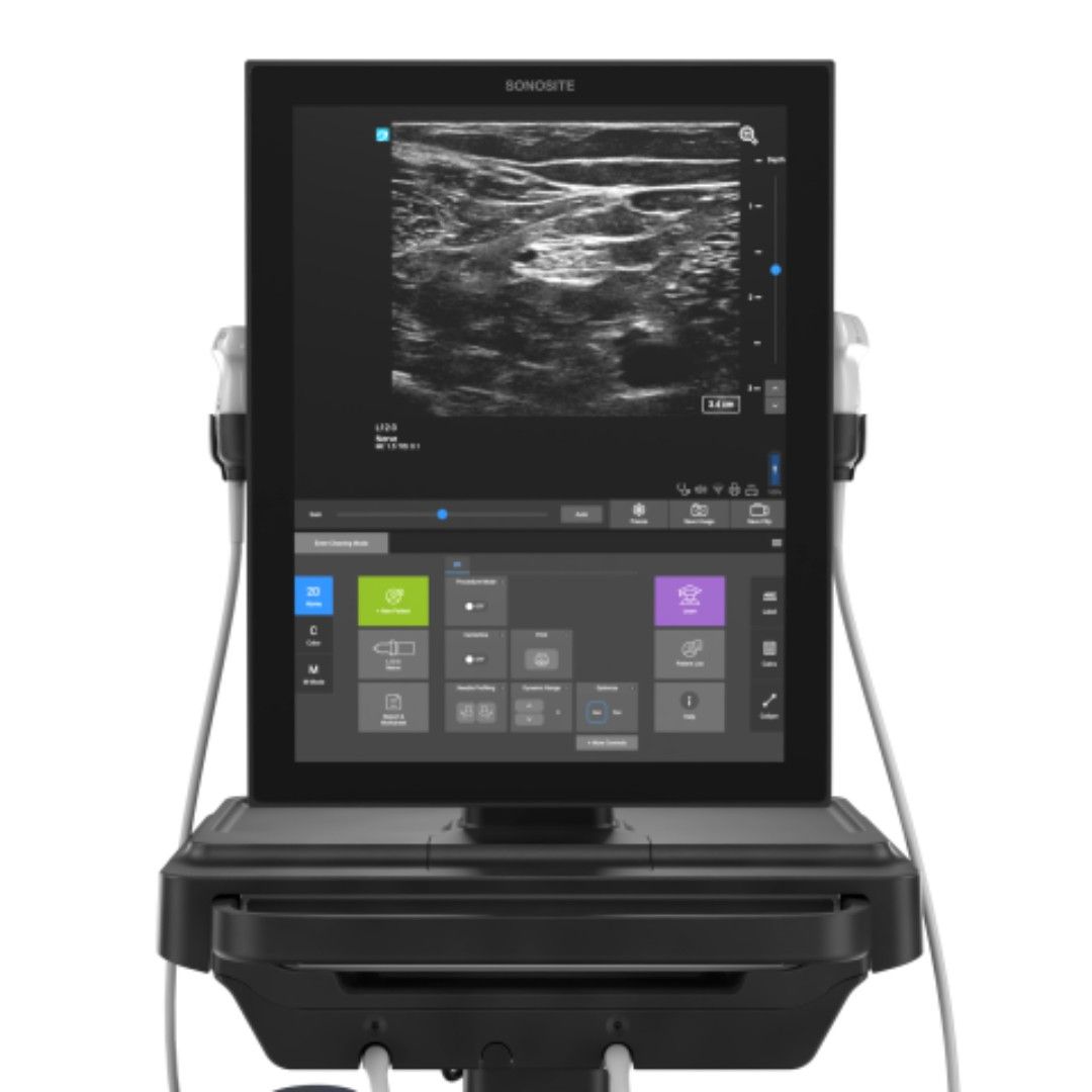 Buy Sonosite ST Ultrasound System From FUJIFILM Sonosite, Inc. | Medzell