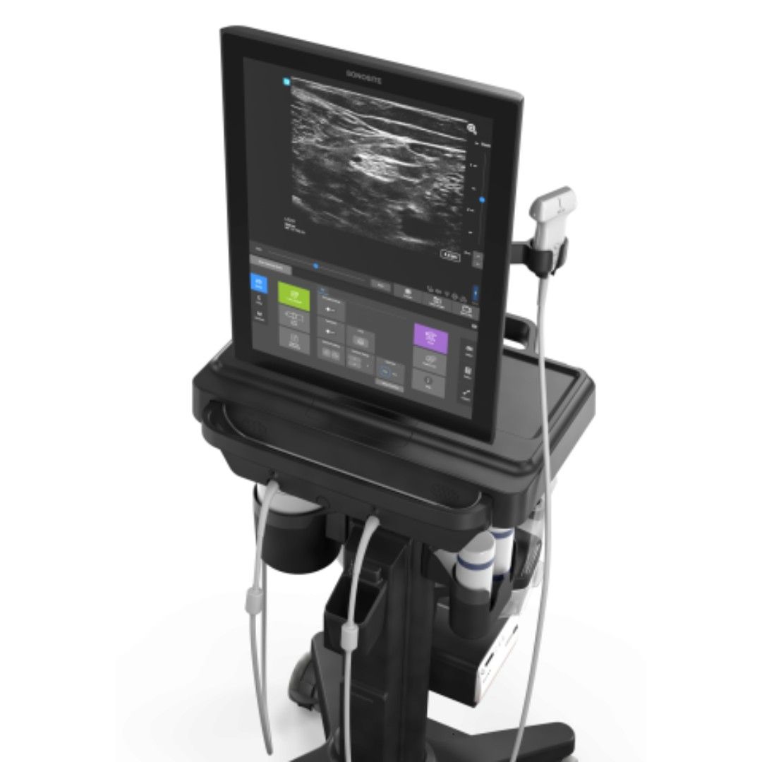 Buy Sonosite ST Ultrasound System From FUJIFILM Sonosite, Inc. | Medzell