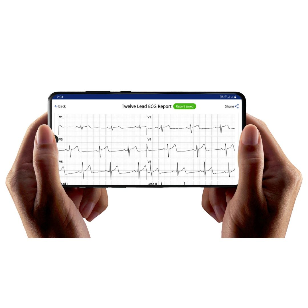 Spandan 4.0 Portable 12-lead ECG Device | Buy ECG Machine Online | Sunfox Technologies