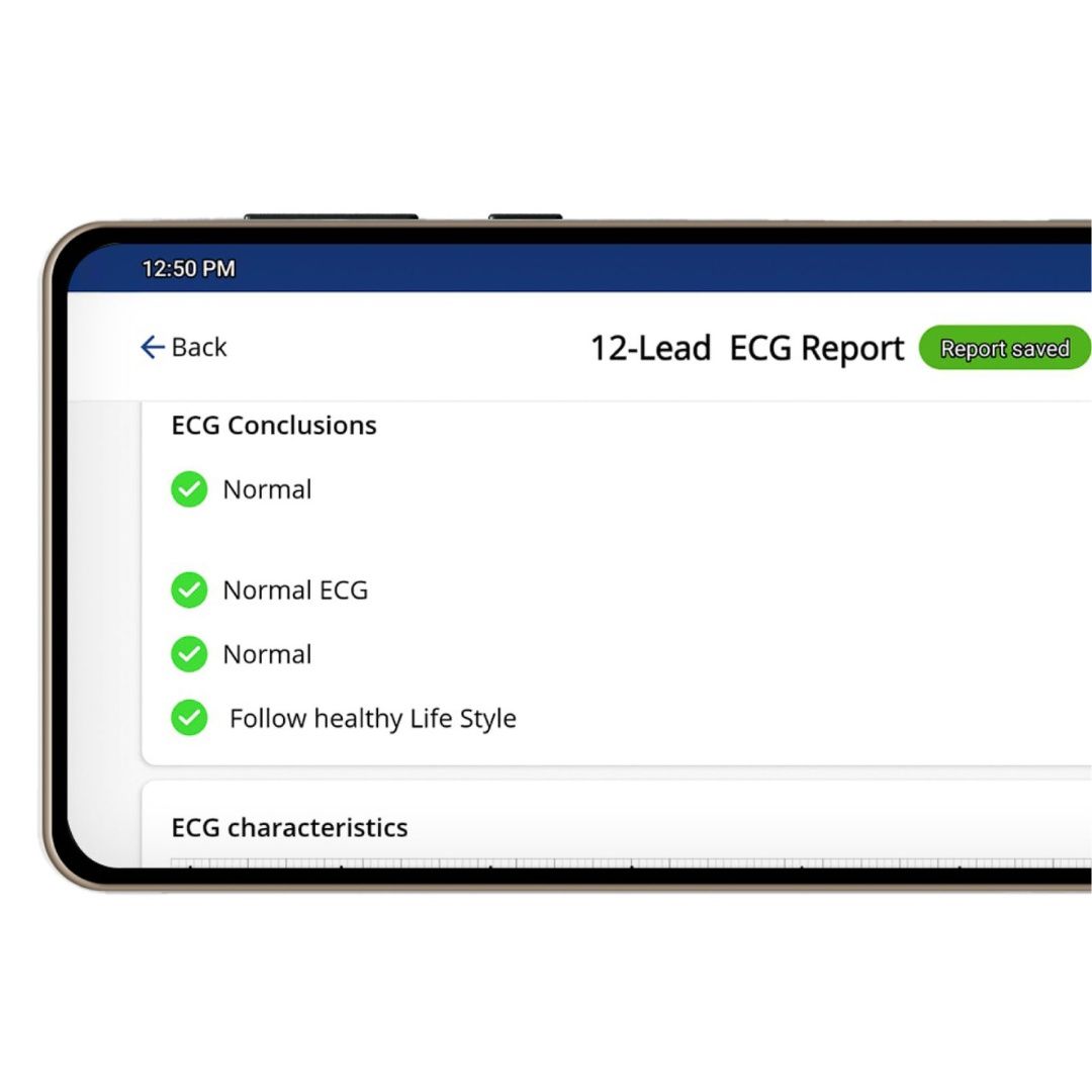 Spandan 4.0 Portable 12-lead ECG Device | Buy ECG Machine Online | Sunfox Technologies