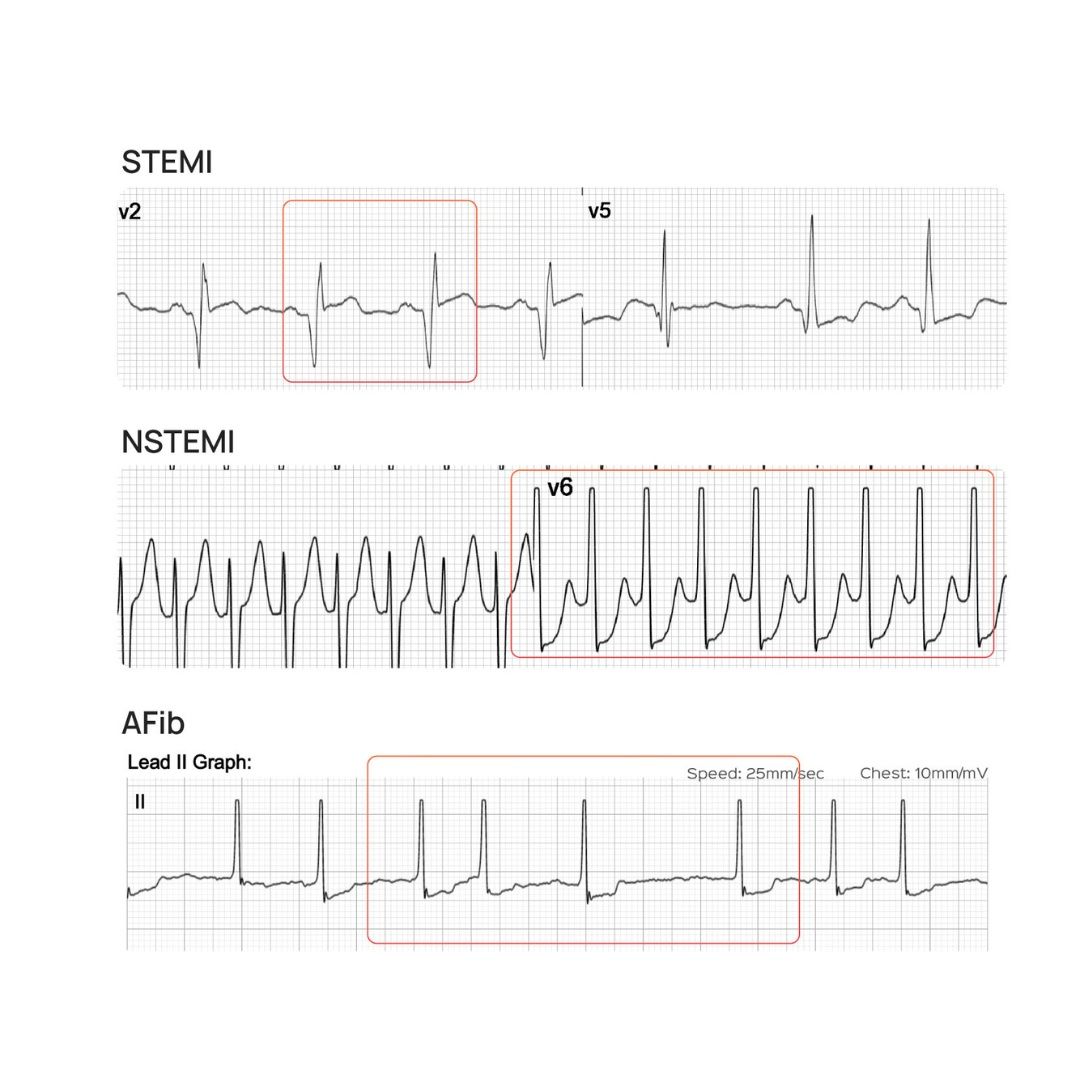 Spandan 4.0 Portable 12-lead ECG Device | Buy ECG Machine Online ...
