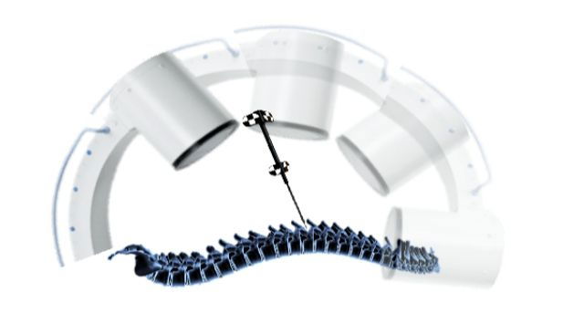 easyNav 2.0 Spine Navigation System - Top Spinal Surgery Navigation ...