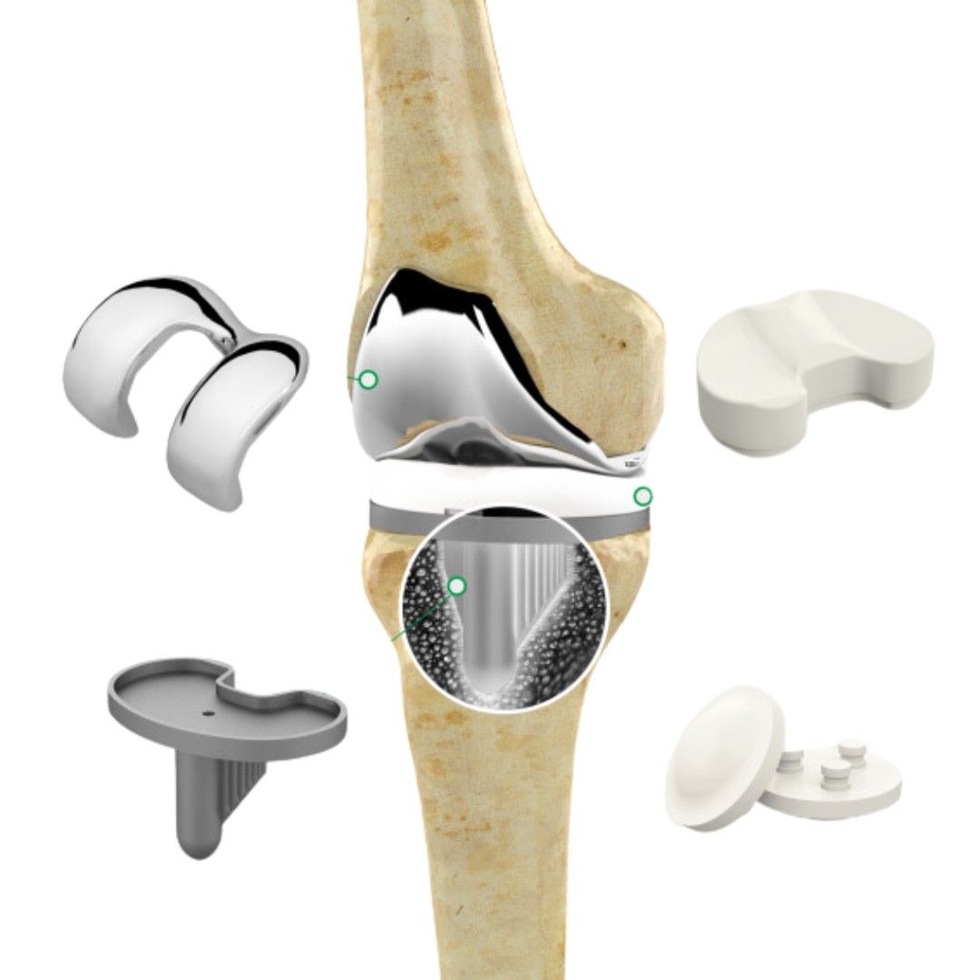 Buy Total Knee Prosthesis C/R - ZİMED MEDİKAL SAN VE TİC LTD ŞTİ