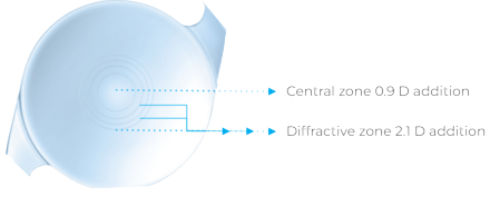 Aurovue Vivid - Intraocular Lenses (IOLs) - Aurolab | Medzell