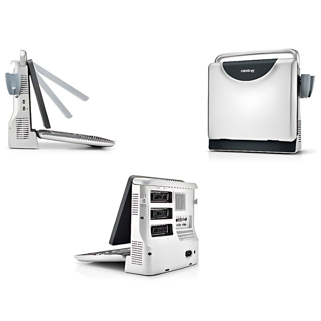 Z60 Ultrasound System for Sale | Affordable High-Quality Imaging | Mindray